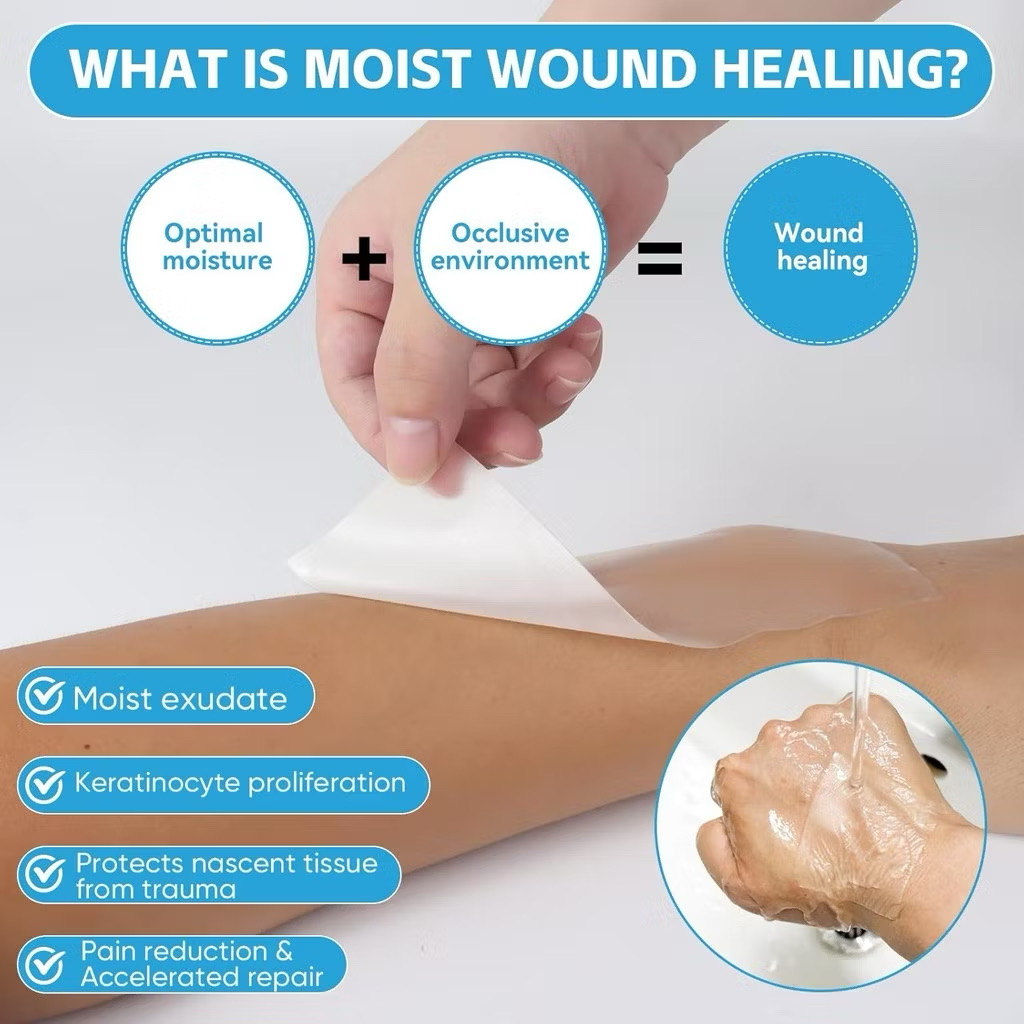 Tt Grade Hydrocolloid Sheet Roll – Cut-to-Fit Dressing for Wound Care ...