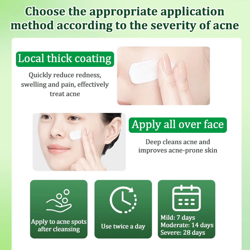 Salicylic Acid Acne Face Cream 30g Acne Mark Removal Effective Repair ...