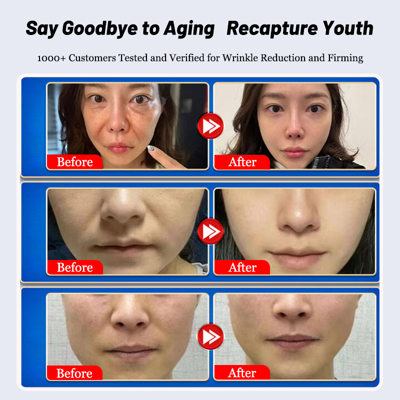 【Original products】LYDIMOON Anti-wrinkle patch Nasolabial fold patch ...