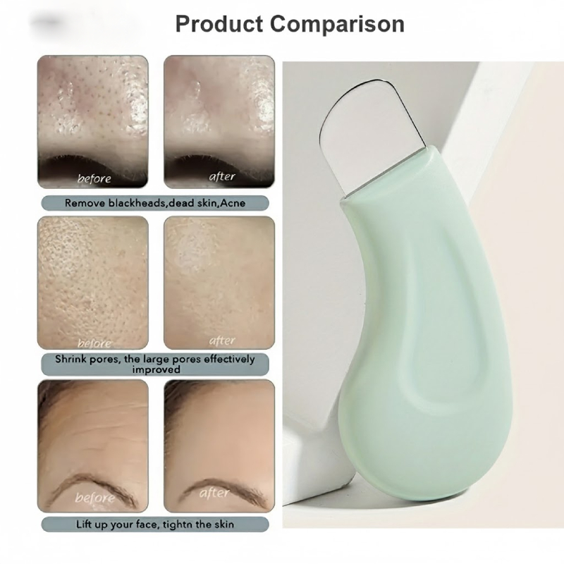 Silicone Blackhead Acne Scraper Facial Cleaner Home Salon Beauty Tool ...