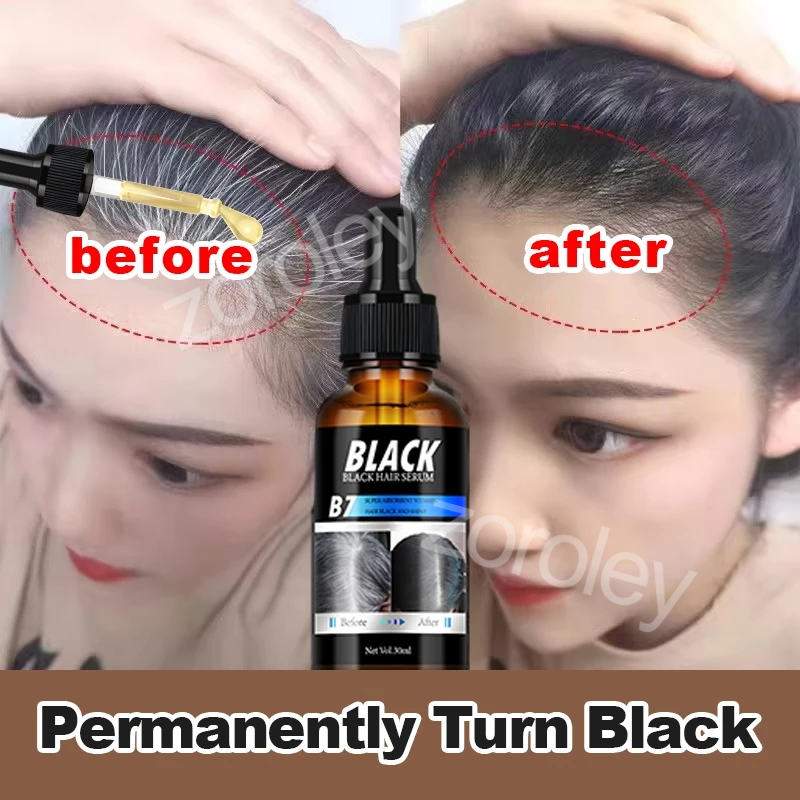 Black Hair Serum Scalp Oil Natural White Hair To Black Hair Growth For ...