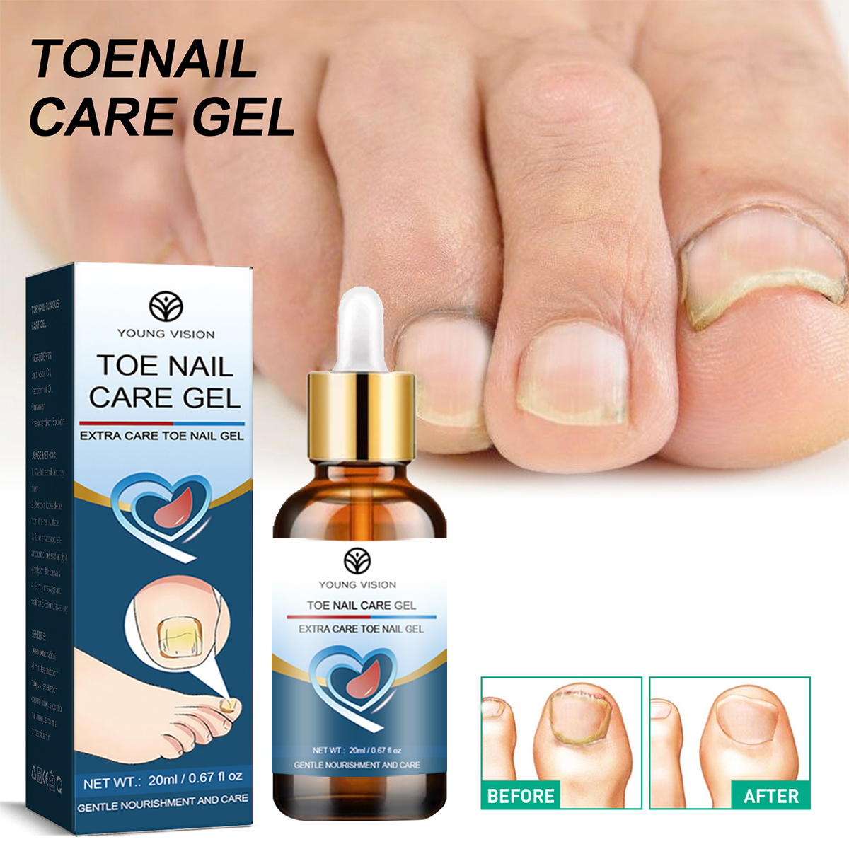 Toenail Care Essential Oil Hand Foot Yellowing Thickening Soft Nail ...