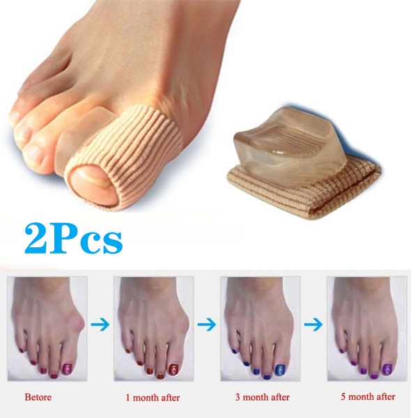 Orthopaedic surgery toe bursitis foot nursing foot therapy silicon pad ...