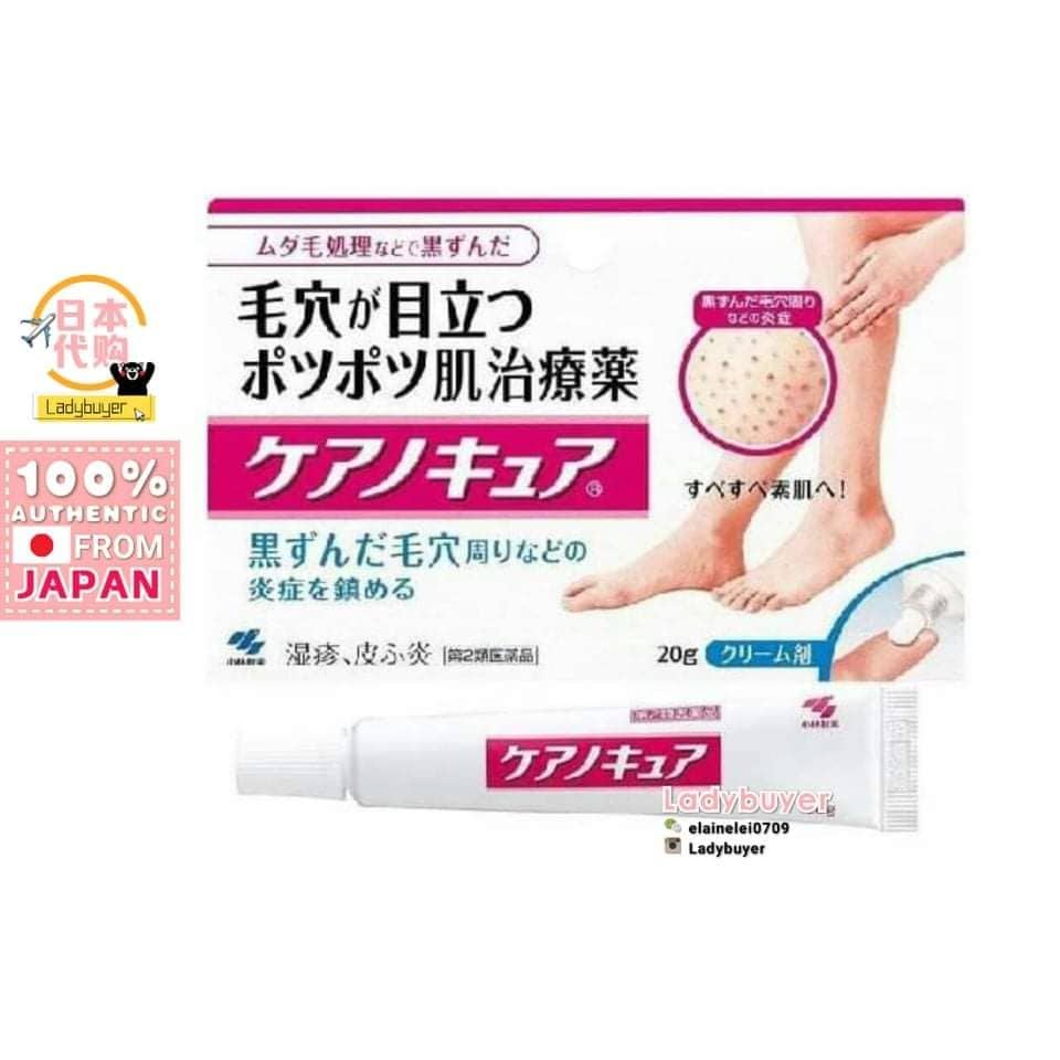 Japan Kobayashi Legs Foot Goose Bumps Remover Care 20g | Shopee Singapore
