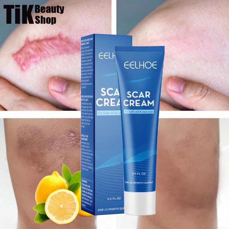 Effective 30ML Scar Cream Remover Acne Scar Remover Gel Serum Cream ...