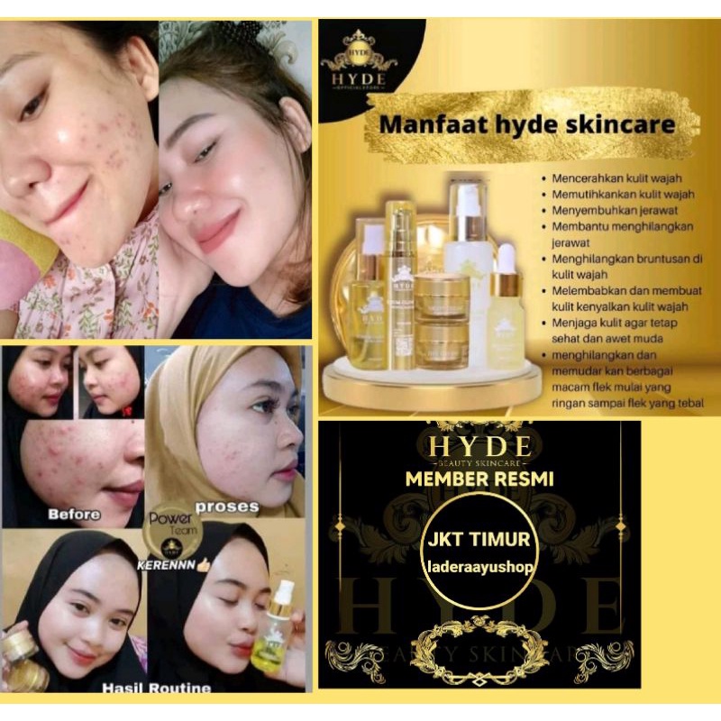 Cream Cream Cream Cream Hyde Skincare ORIGINAL BPOM All Package And ...