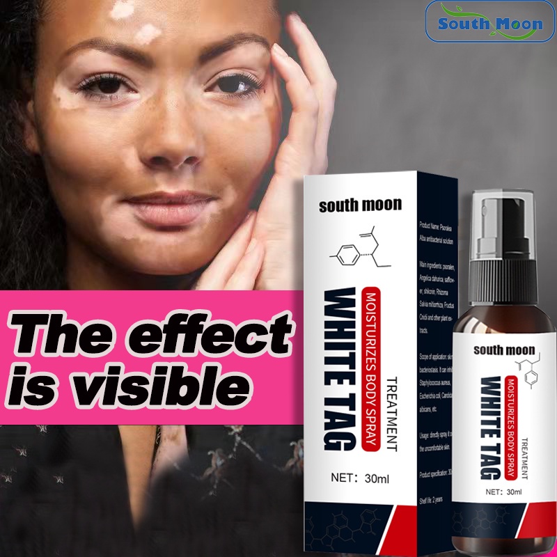 South Moon Vitiligo Treatment Cream Mustard Oil For Vitiligo Remover ...