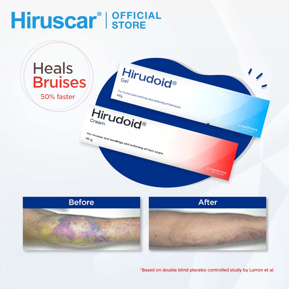 [Hiruscar Official] Hirudoid Cream 40g | Bruise Treatment | Shopee ...