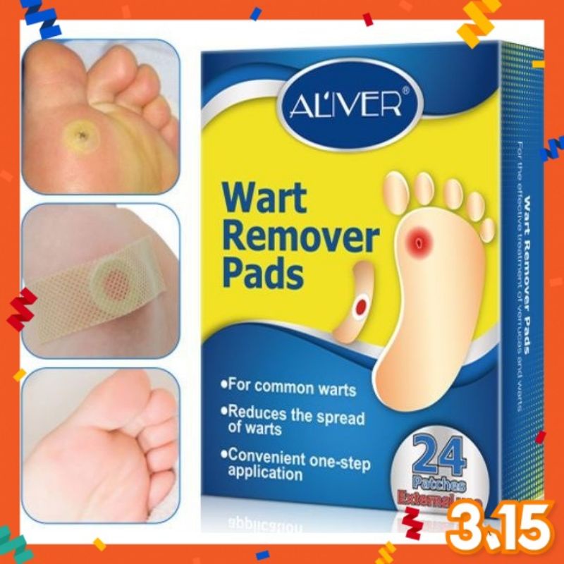 ALIVER Wart Remover Pads / Corn Remover 鸡眼贴 24 PATCHES PER BOX | Shopee ...