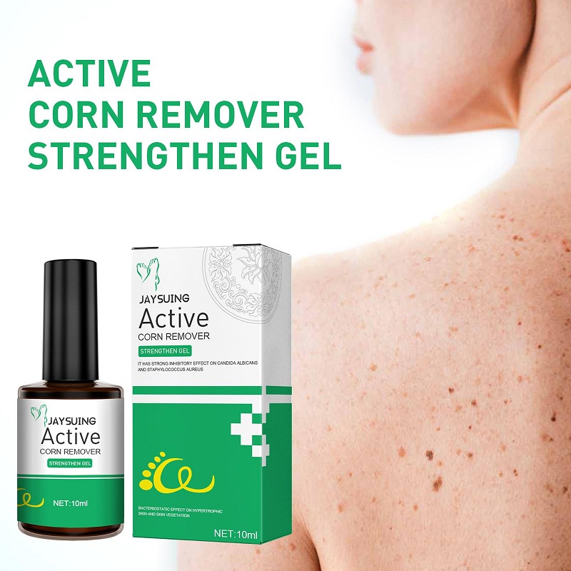 Effectively Remove Foot Corn Care Cream Remove Foot Calluses Remove ...