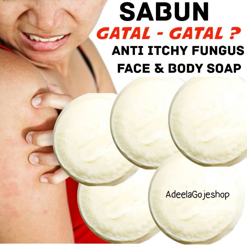 Itchy Soap/ Acne/ Scabies/ Ringworm/ Ezcema/ Psoriasis 170g | Shopee ...