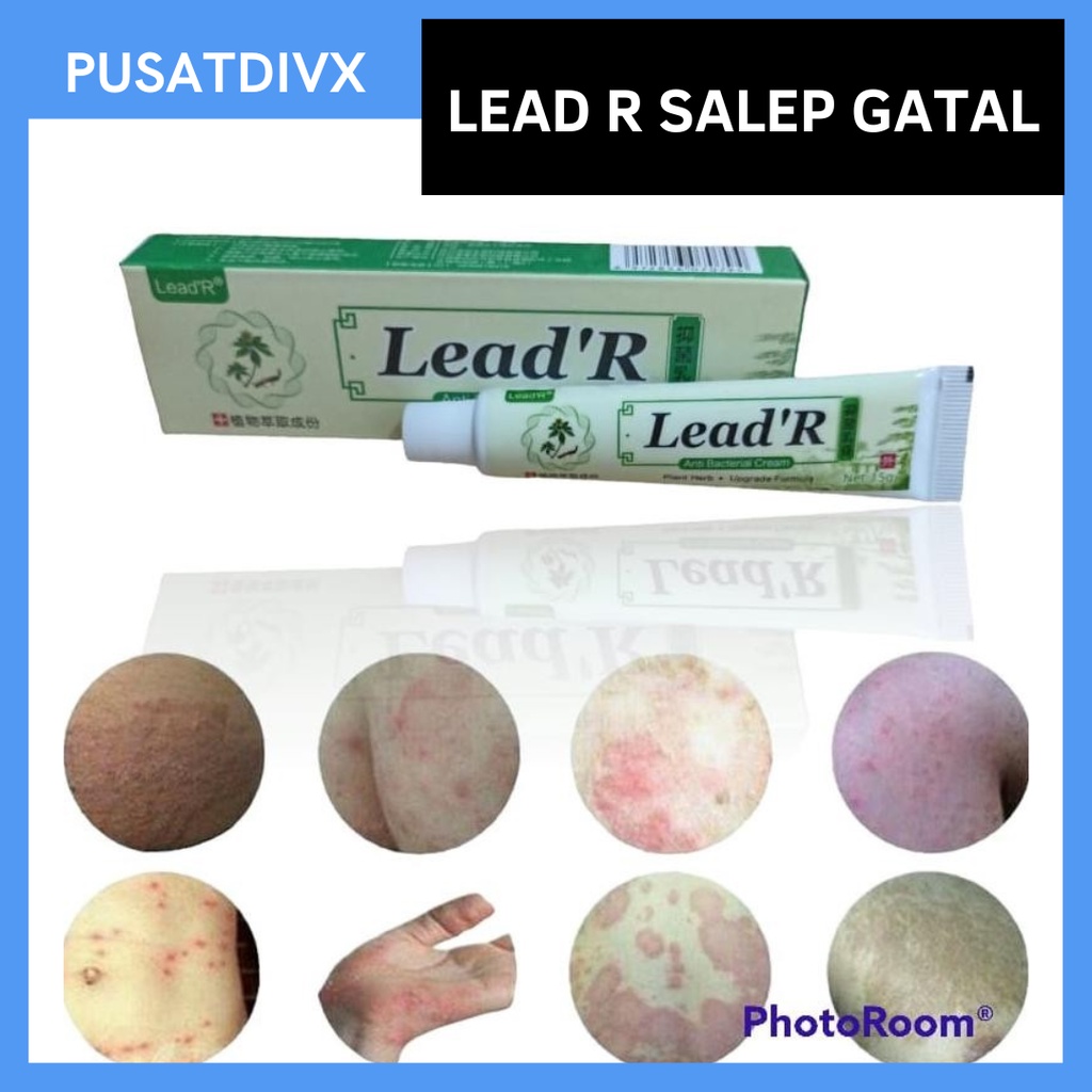 Lead'r Itching Medicine Ointment Skin Fungus DERMATITIS PSORIASIS ...
