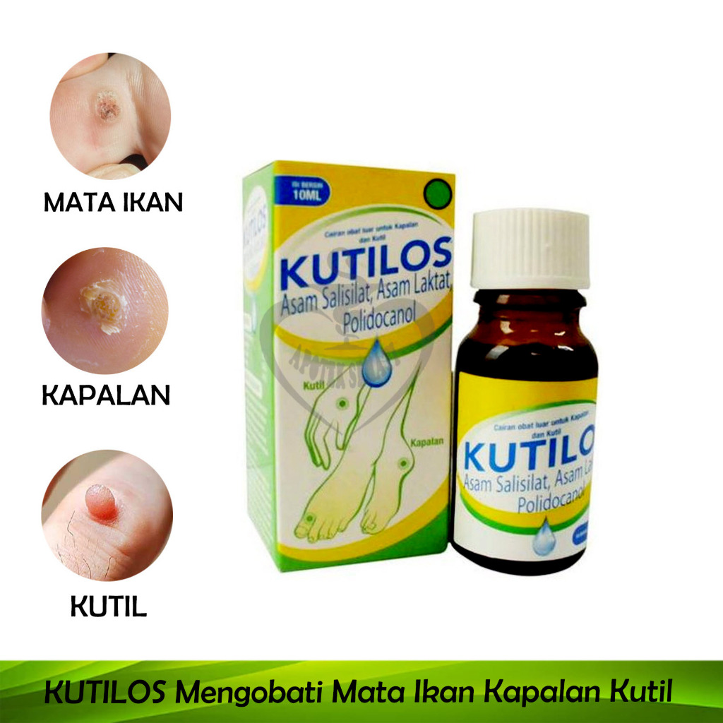 MATA Kutilos 10 ML Original - Corn Eye Callus Wart Medicine 10 ML ...