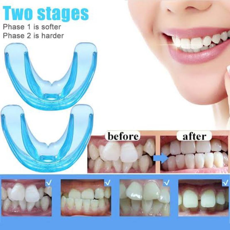 Teeth REPLACE BEHEL ORIGINAL teeth REPAIRS MEMORIES USA retainer teeth ...