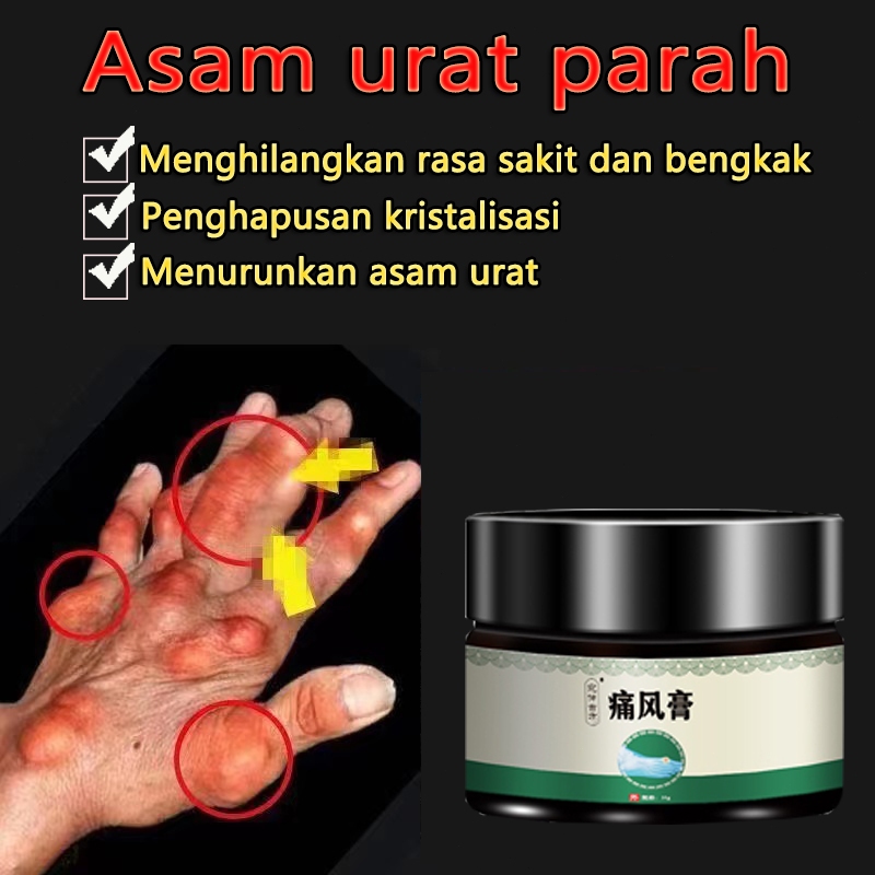 (Original Item)salep Gout - Gout - Gout Medicine 35g Gout Inflammation ...