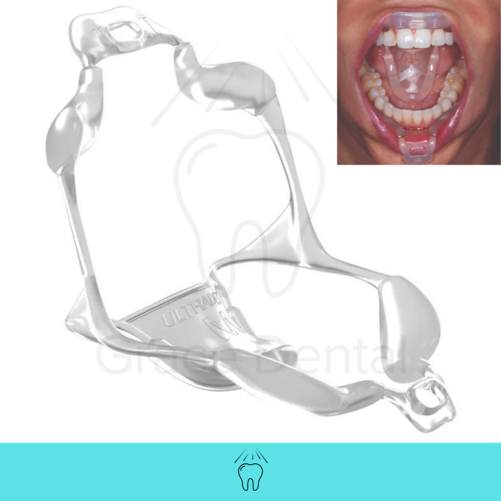 Mouth Retractor Umbrella Ultradent Lip Cheek Retractor | Shopee Singapore