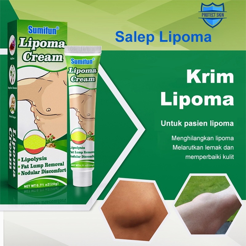 Lipoma Ointment Lumps Ointment 20g Lumps Medicines Lumps Remover Lumps ...