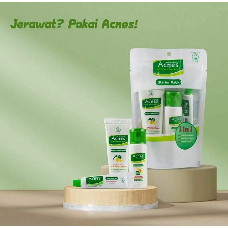 Acnes Starter Pack - Creamy Wash + Powder Lotion + Sealing Jell (Treat ...