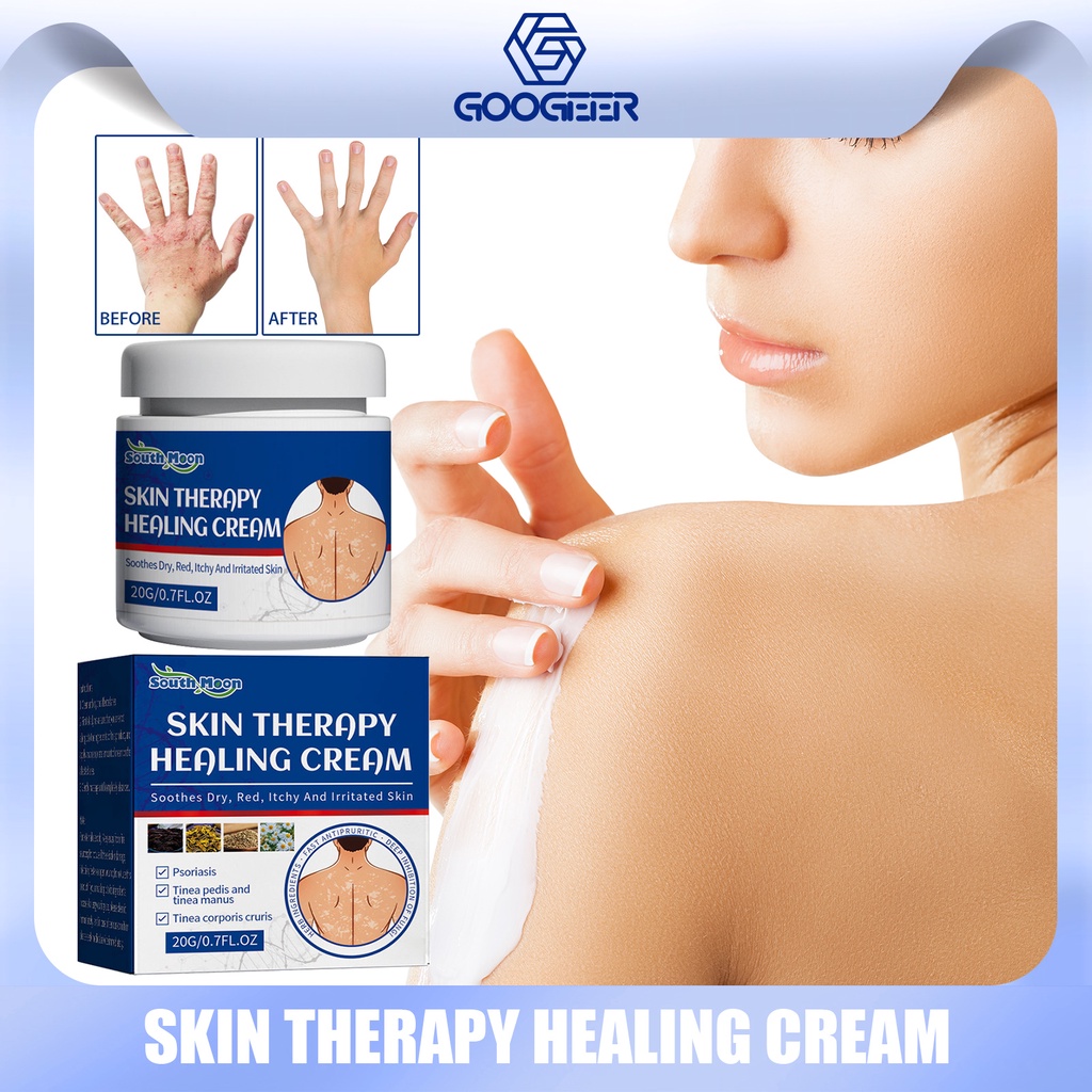 South Moon Skin Therapy Healing Cream Skin Antipruritic Cream Itch ...