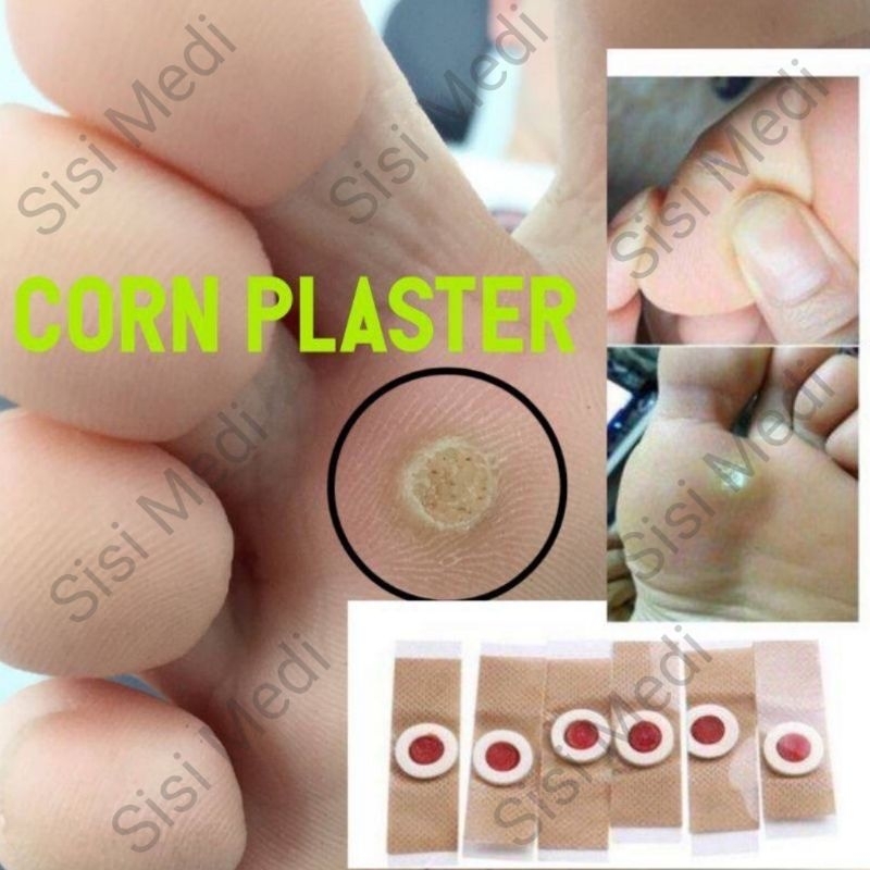 Plaster Ketuat Corn Wart Plaster 6pcs | Shopee Singapore