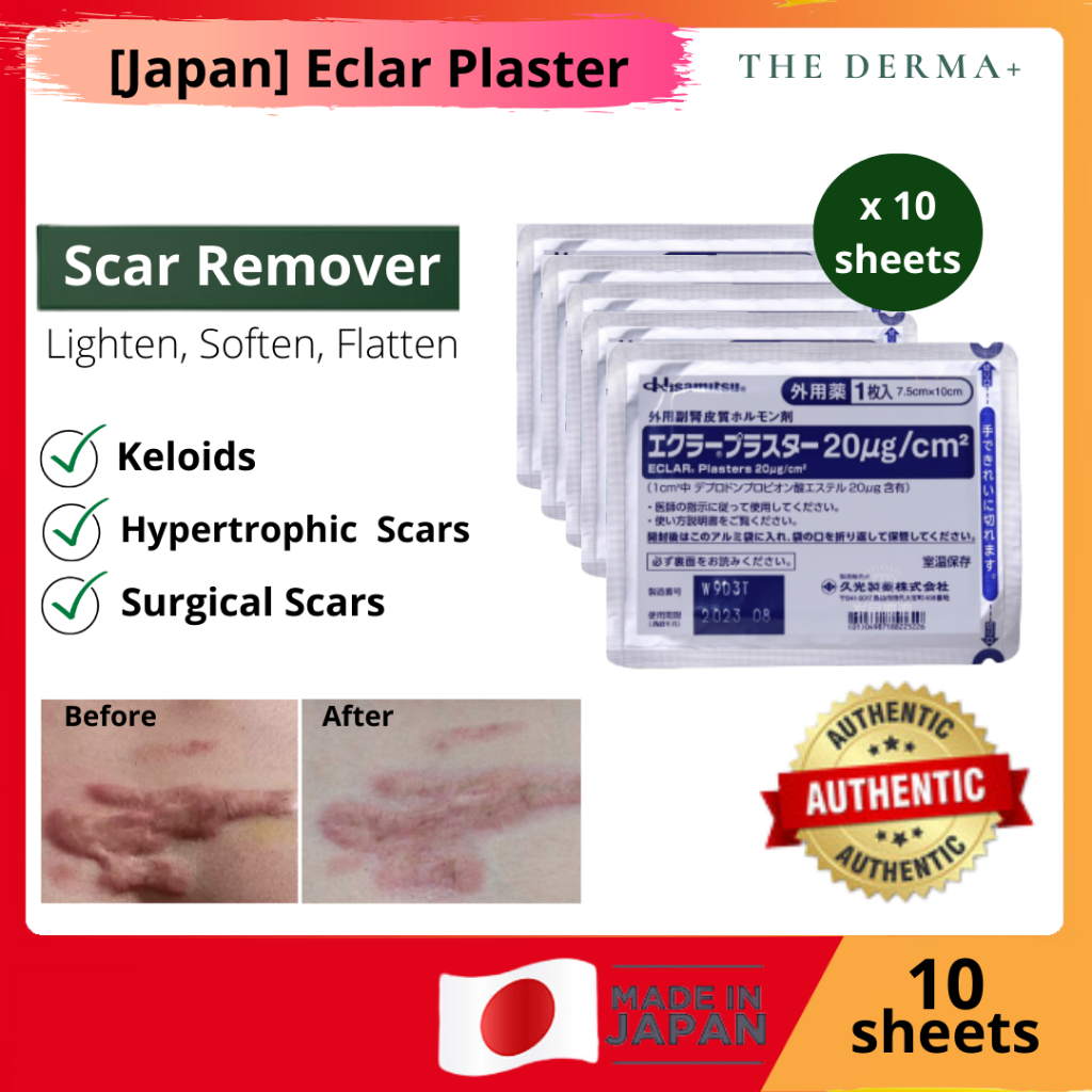 [Japan] Scar Removal / Keloid Treatment - Hisamitsu Eclar Plaster 日本久光 ...