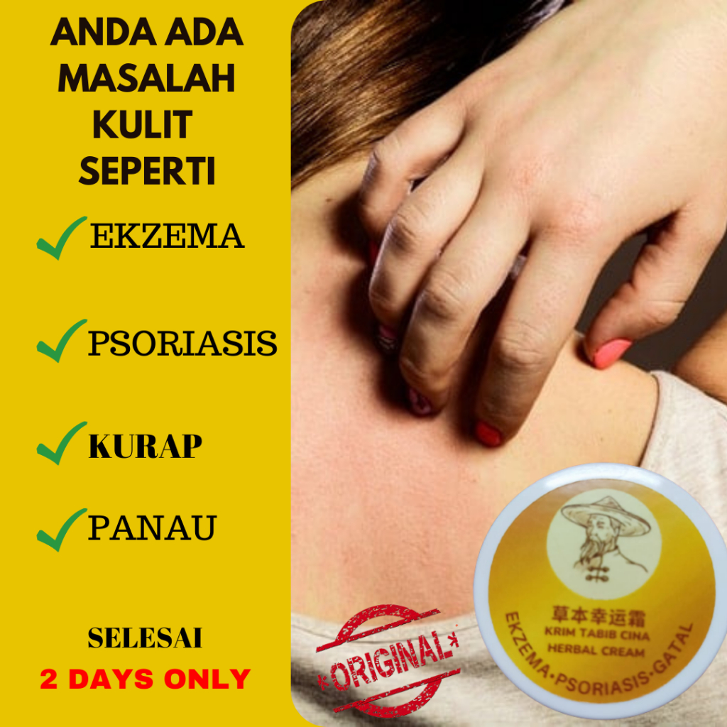 Ringworm cream panau eczema scabies psoriasis medicine Chinese healer ...