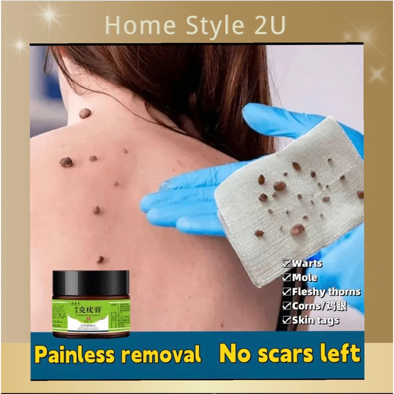 wart remover warts removal cream ubat buang tahi lalat buang kutil Neck ...