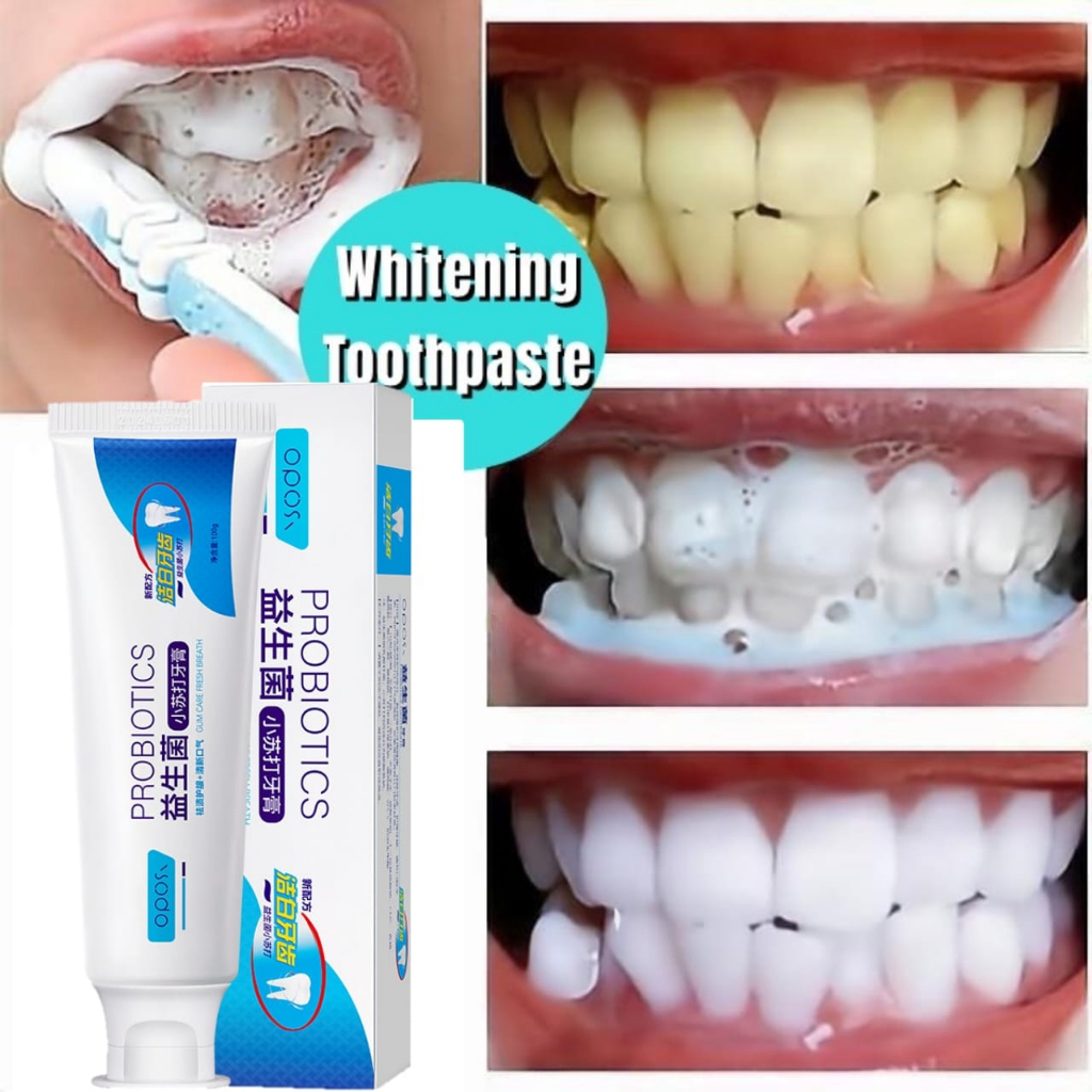 Probiotic Whitening Refresh Toothpaste Shark Toothpaste Oral cleaning ...
