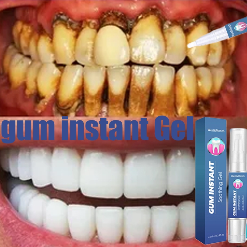 Gum Instant Soothing Gel Receding Gums Therapy Inflammation Treatment