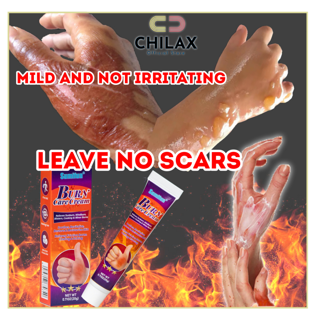 Burn Care Cream Cream Luka Bakar Pain Relief Antiseptics Fast Relief ...