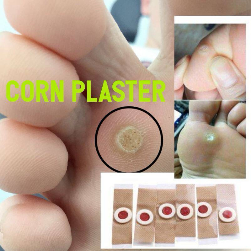 HITAM Corn PATCH remover 6Pcs skin tag remover removes warts, warts ...
