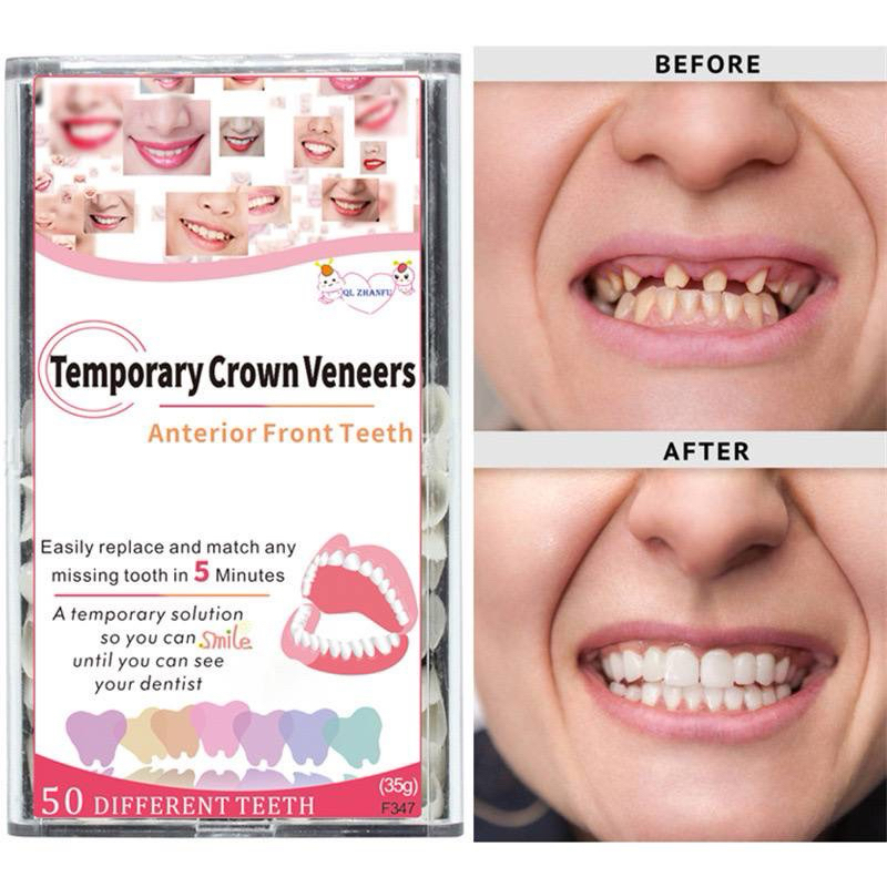 TEMPORARY CROWN VENEERS MOLAR TEETH gigi palsu flase teeth crown teeth ...