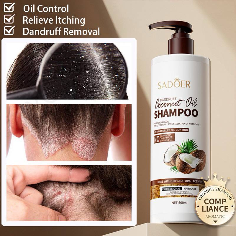 Sadoer anti DANDRUFF shampoo anti DANDRUFF shampoo DANDRUFF treatment ...