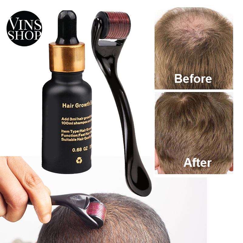 VINS Hair Grow Micro Needle Roller Derma Roller Dermaroller Scalp Hair ...