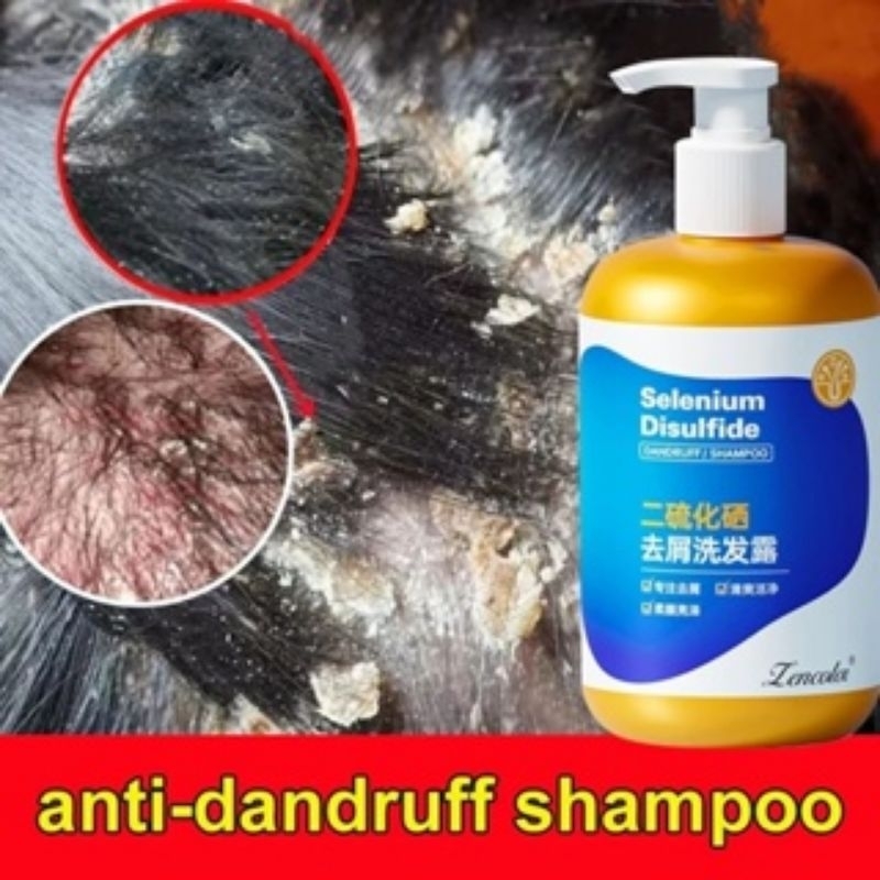 300ml Selenium disulfide anti-dandruff shampoo 二硫化硒去屑洗发水 | Shopee Singapore