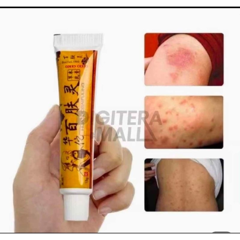 Ringworm /kudis Antibacterial Anti-fungal cream | Shopee Singapore