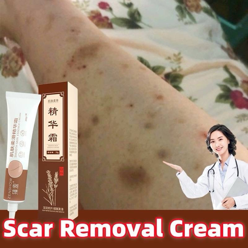 HITAM Skin Smoothing Essence Cream anti-Scar anti-Scar Cream removes ...