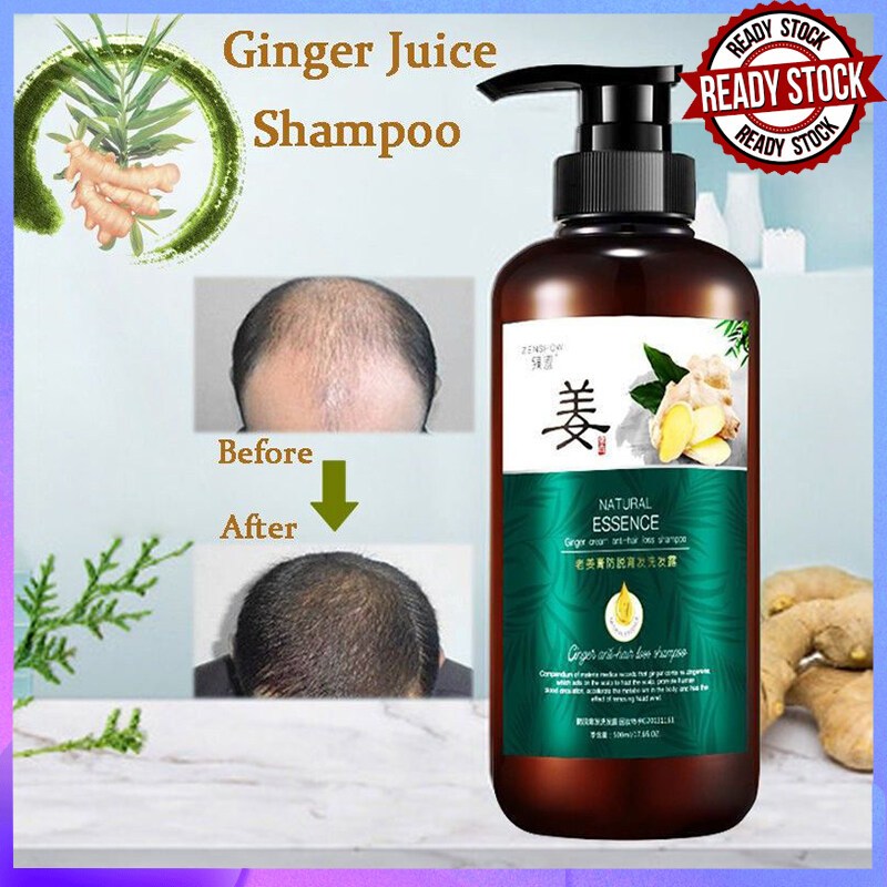 Ginger Hair Growth Shampoo Anti-Hair Loss Promote Thicker Remove Hair ...