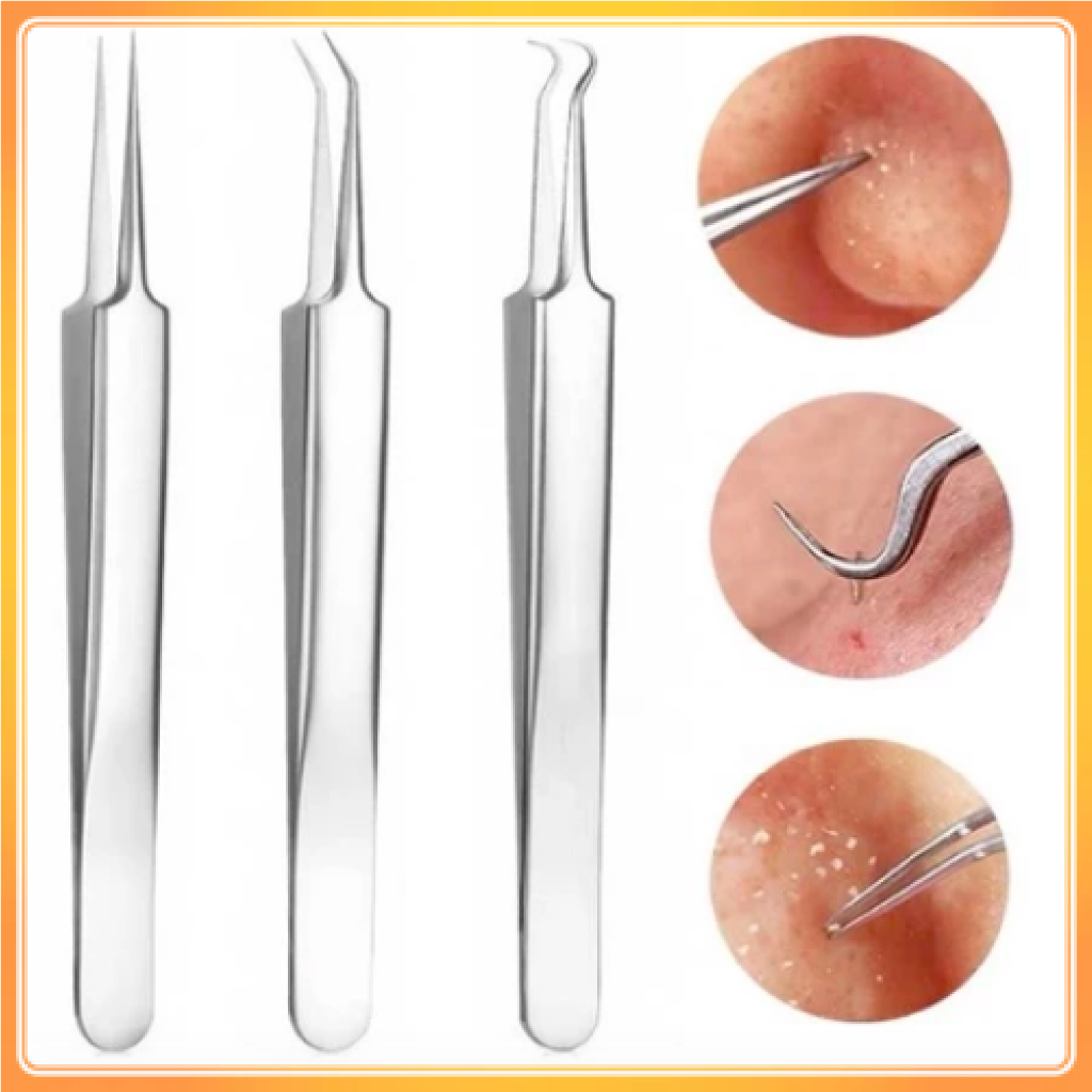 Blackhead Acne Clip Comedone Pimple Extractor Remover Tweezer ...