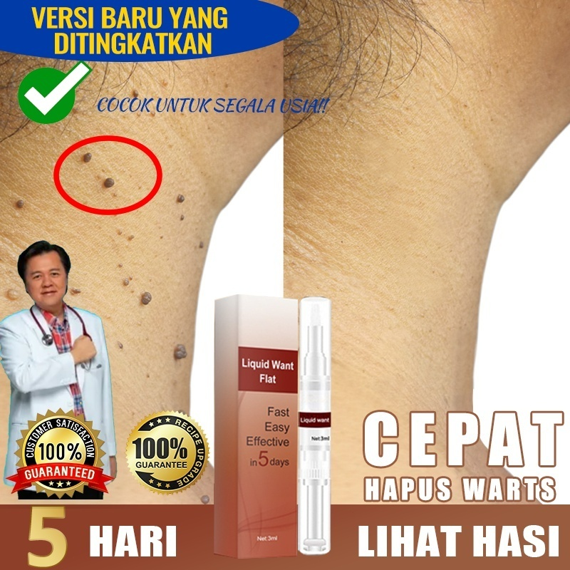 Ubat ketuat Tahi lalat remover Skin tag remover Buang tahi lalat dan ...
