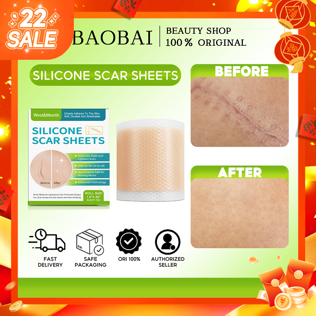 West&Month silicone scar sheet silicone scar removal patch Acne mark ...