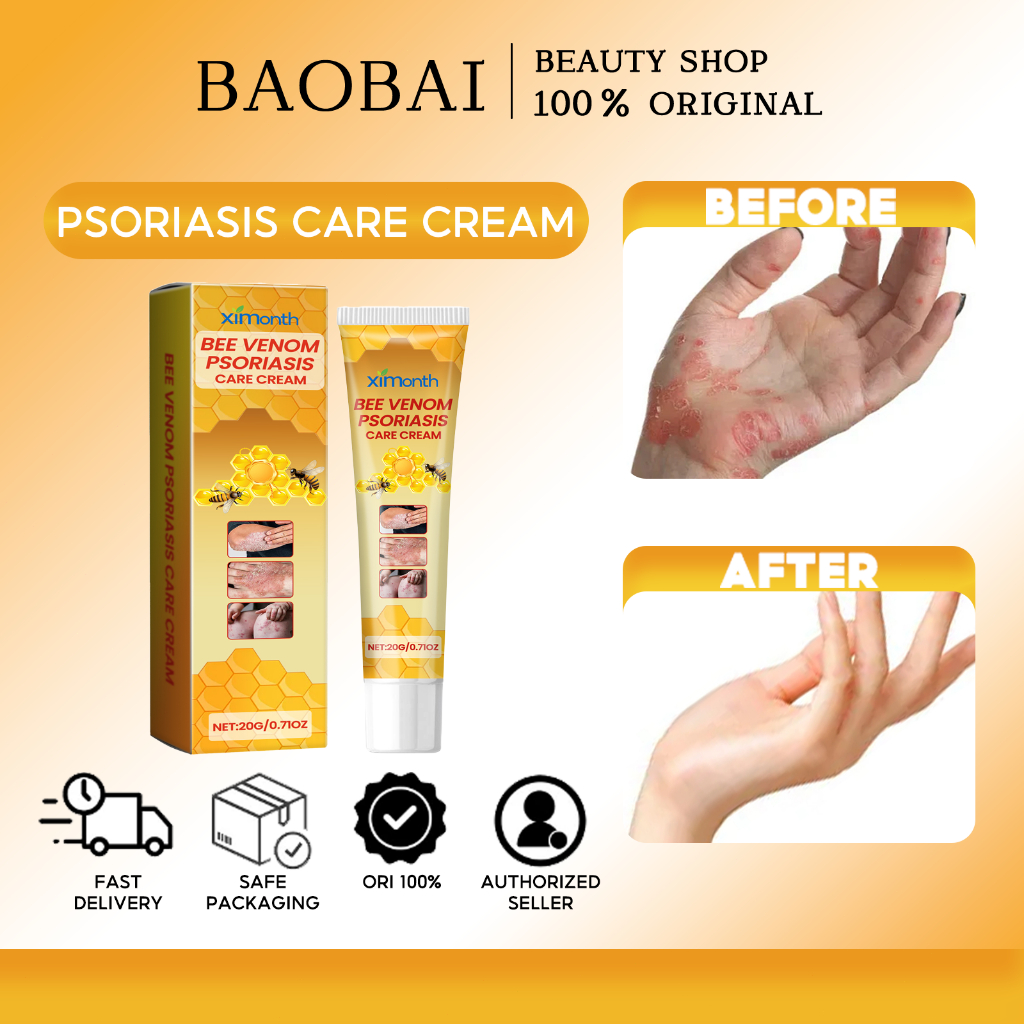 Ximonth Bee Venom Psoriasis Care Cream Eczema Cream Ubat Gatal Kulit ...