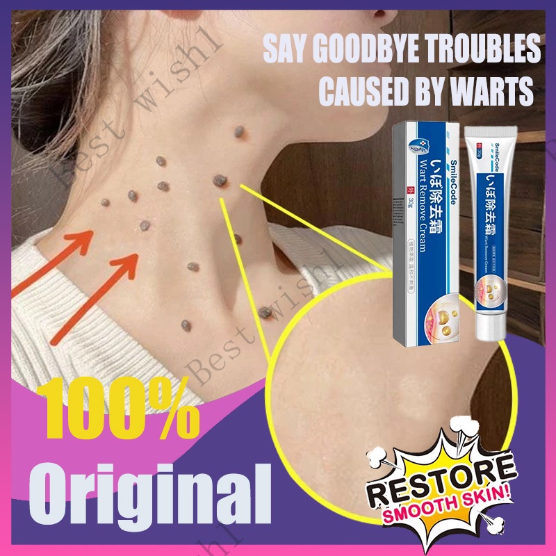 Wart Removal Cream Ubat buang kutil ketuat tahi lalat biji kolestrol ...