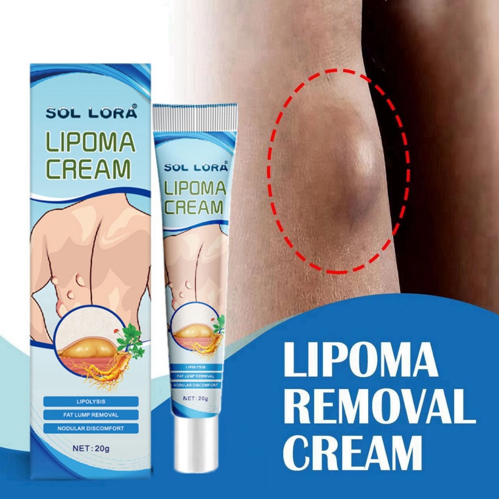 20G Fat lump and mass nursing cream,Gentle,eliminate lumps and bumps ...