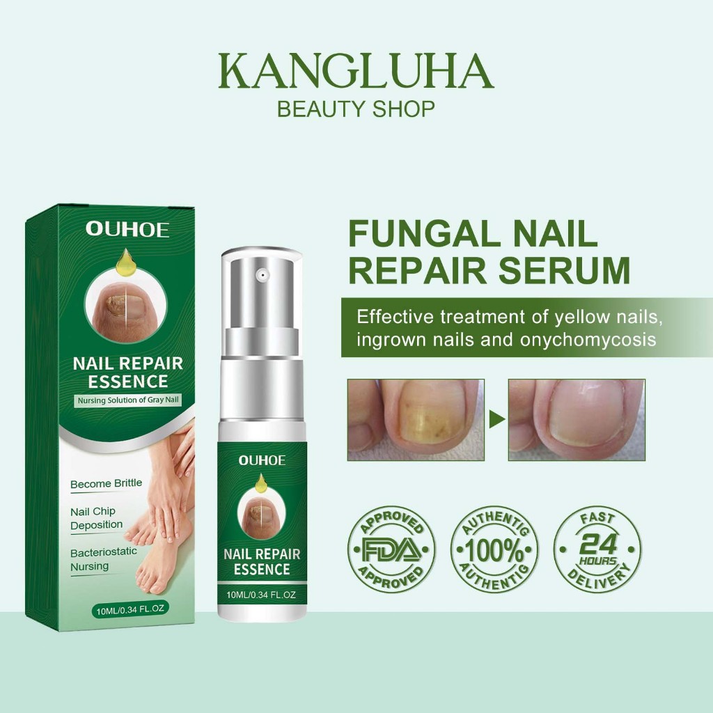 OUHOE Nail Fungal Treatment Anti Infection Toe Fungus Repair Liquid ...