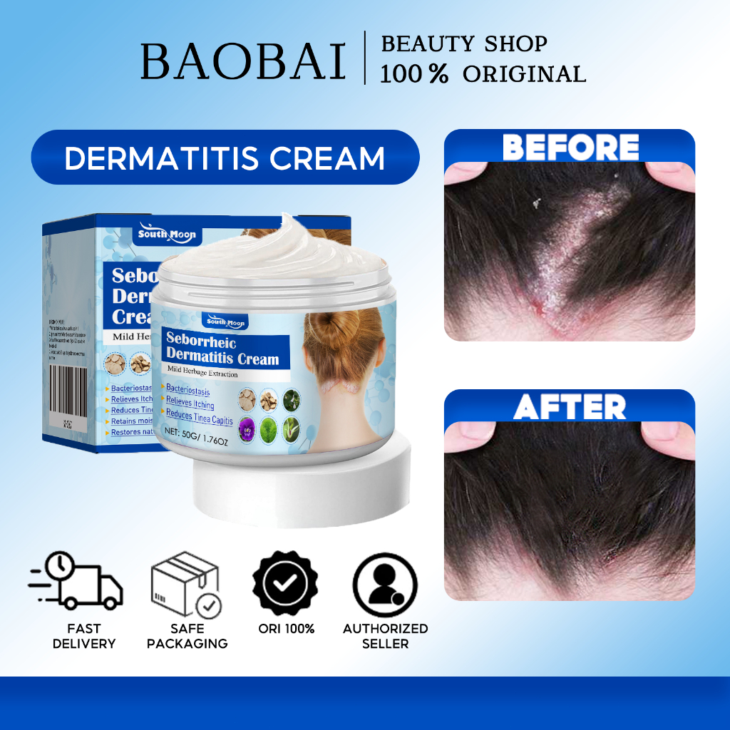 Seborrheic Dermatitis Cream Relieves itching Reduces Tinea Capitis ...