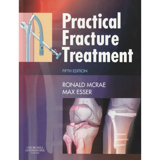 Practical Fracture Treatment 5th Edition | Shopee Singapore