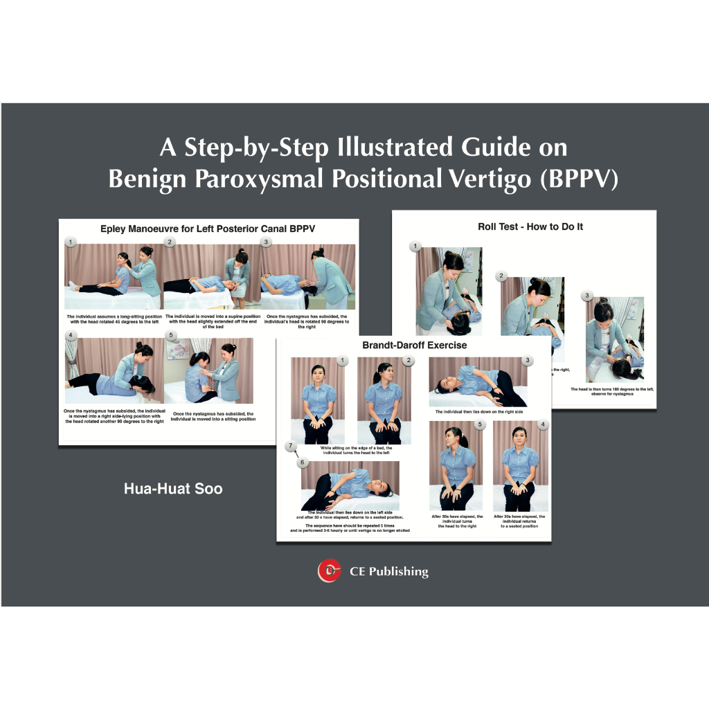 A Step-by-Step Illustrated Guide on Benign Paroxysmal Positional ...