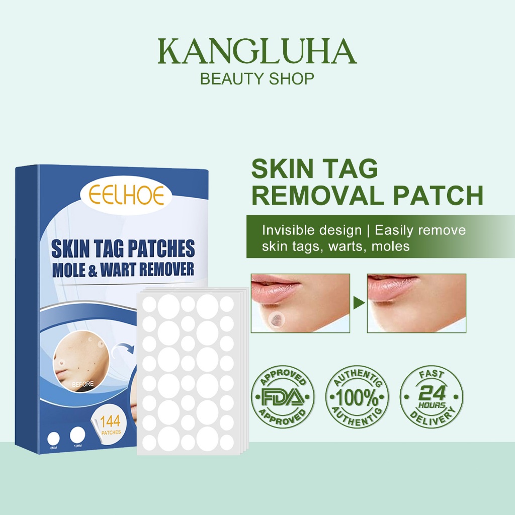 EELHOE Skin tag removal stickers 144pcs tahi lalat remover patch ubat ...
