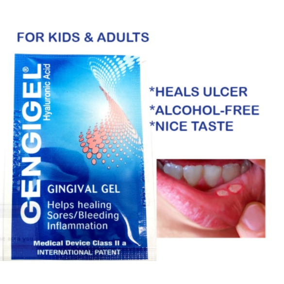 Gengigel Gel 1ml Sachet (Mouth Ulcer Medication) | Shopee Singapore
